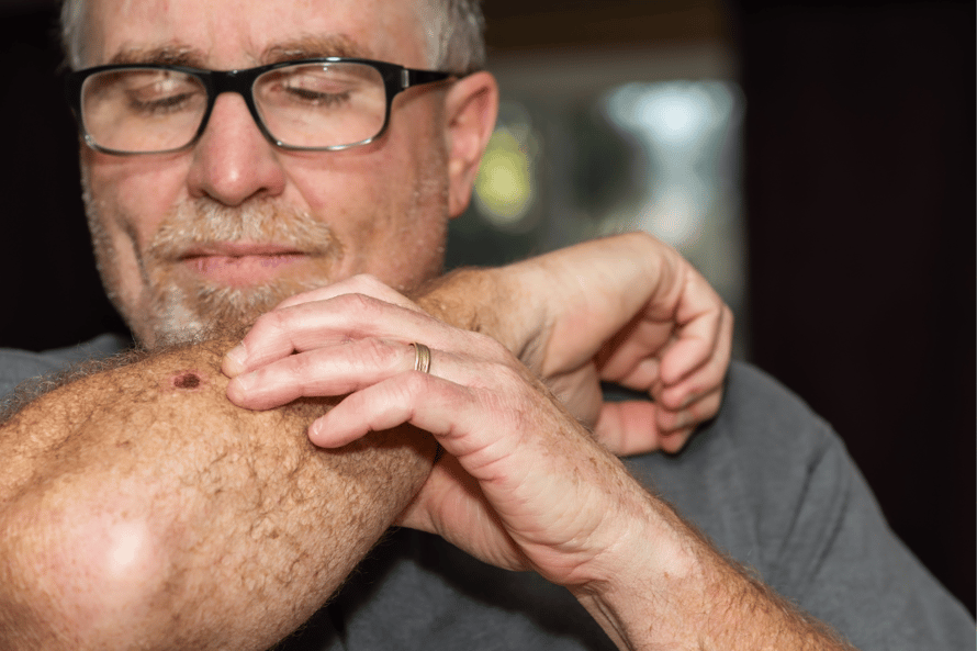 Understand cancer screening options for early detection.